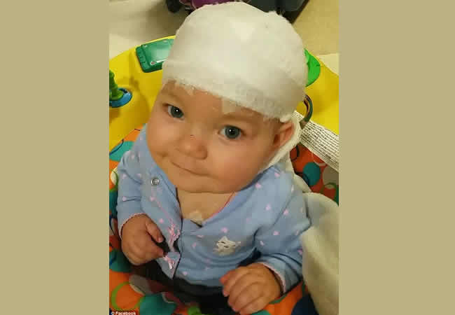 Baby suffers stroke in the womb, surprises doctors – Punch Newspapers